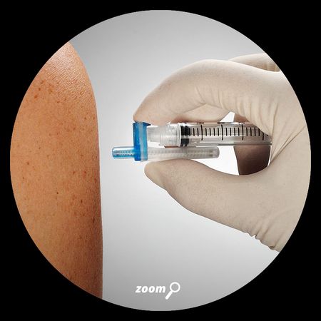 Needle Safety 25G x 5/8" Retractable, 50/Box | Dealmed Medical Supplies