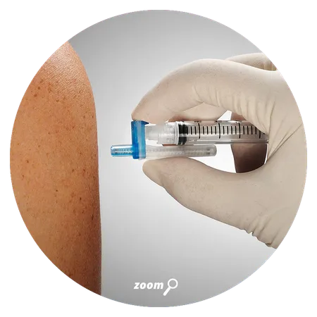 Needle Safety 25G x 1" Retractable, 50/Bx | Dealmed Medical Supplies