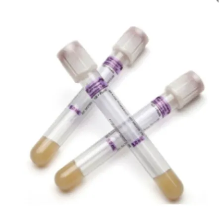 Tube Plasma Preparation 13 x 100 mm 5 mL, 100/Pk | Dealmed Medical Supplies